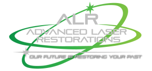 Mobile Laser Cleaning Services